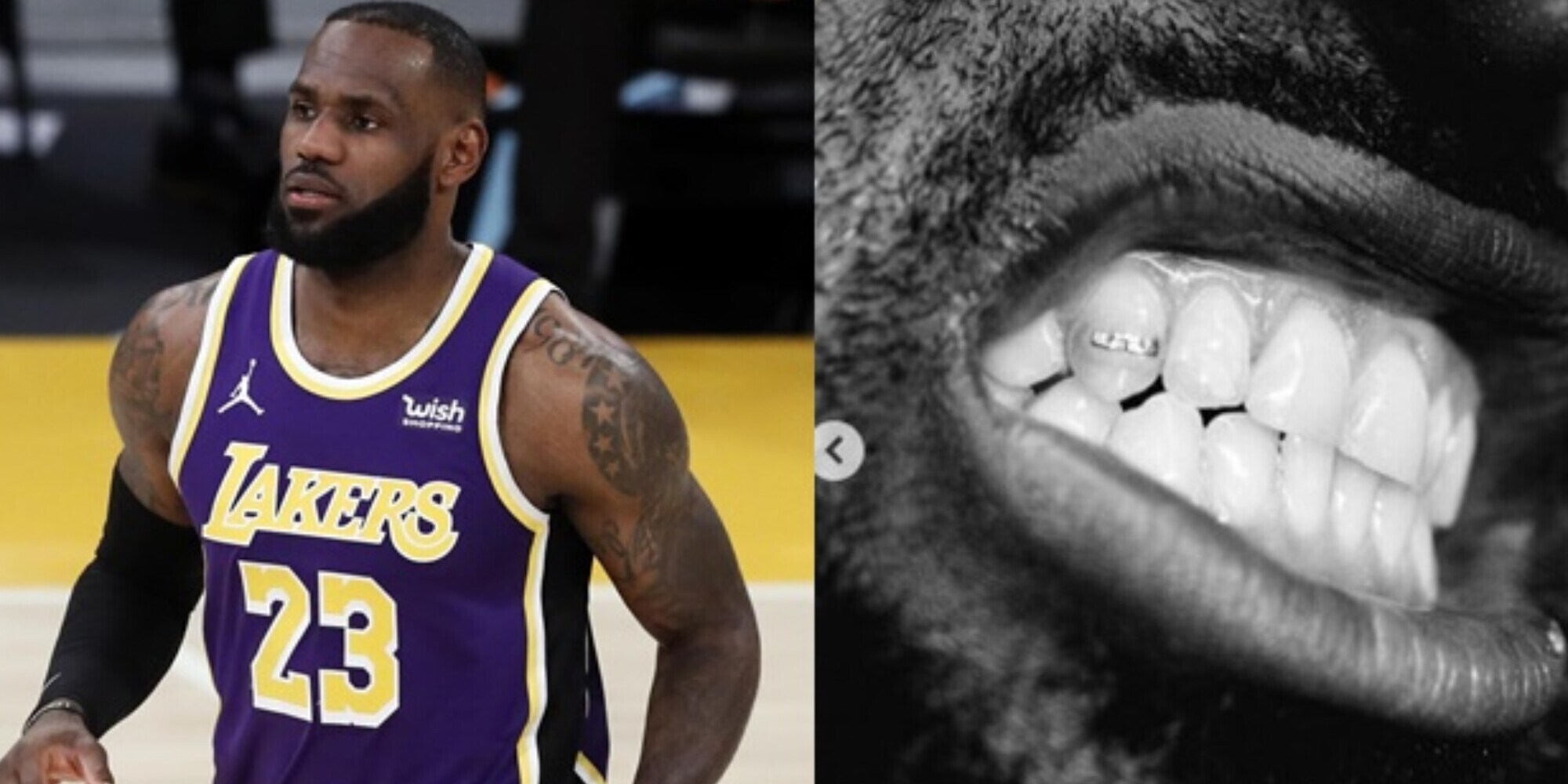 LeBron ed il tattoo sui denti che fa impazzire i fan