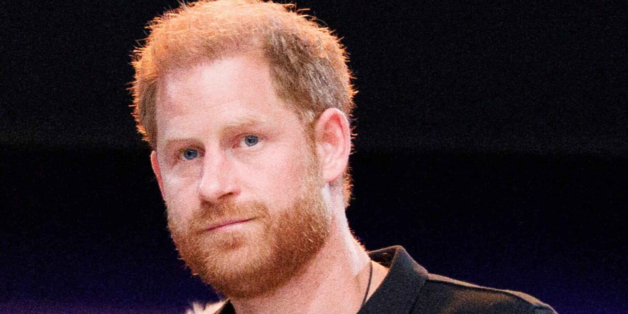 Pagina 1 | Harry, il volto del principe diventa... un livido. Racconto ...