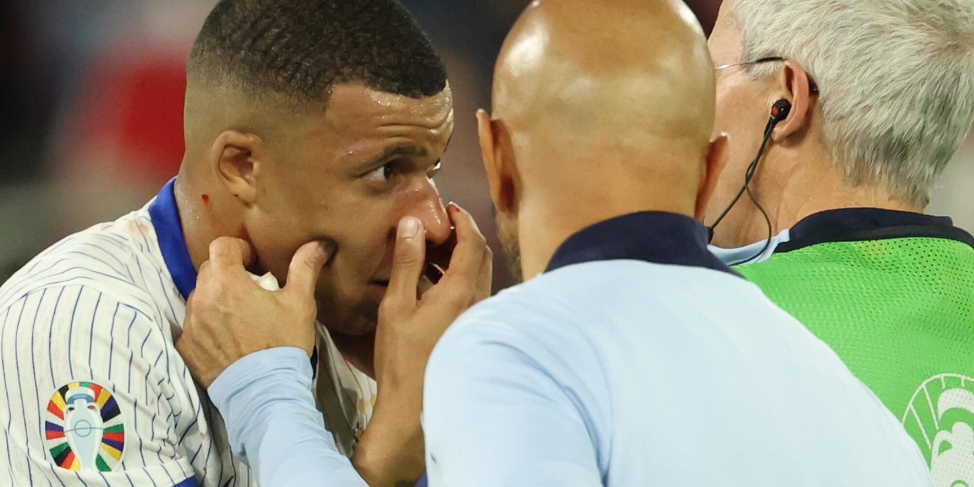 Mbappé, niente operazione al naso: "Idee per una maschera?"