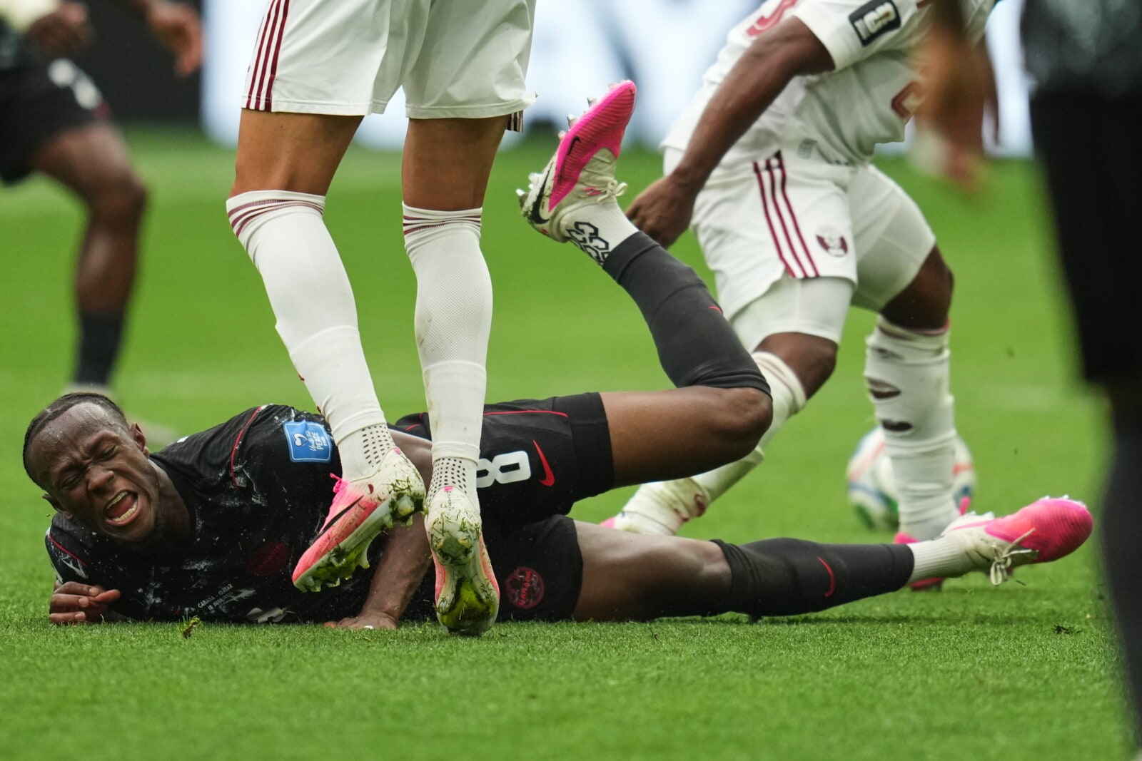 Kone shock, si spezza la gamba dopo un fallo: David e il Canada in lacrime